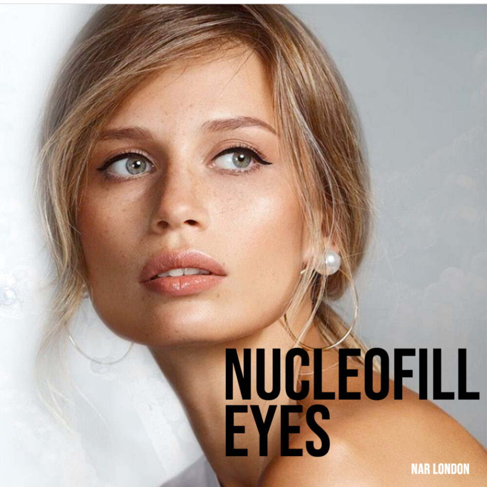 NUCLEOFILL EYES LONDON | Eye Bags Treatment | NAR LONDON Harley Street