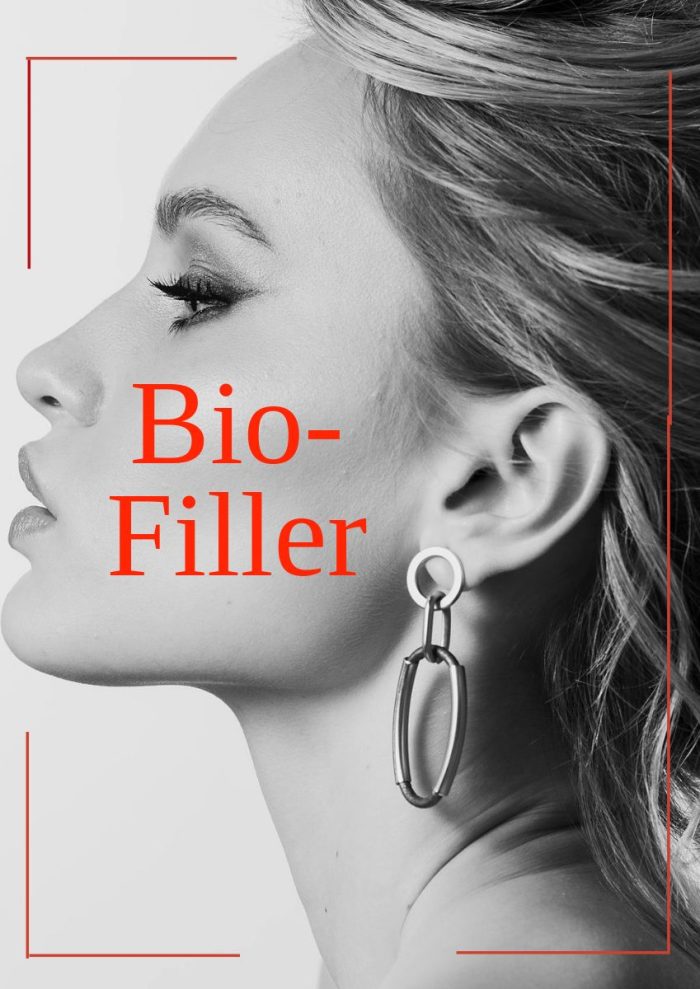 Plasma Biofiller | Skin Rejuvenation | NAR LONDON- Harley Street